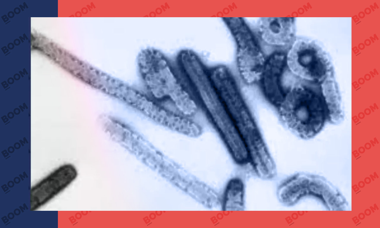 16 Cases, 9 Deaths: What Is Marburg Virus Outbreak In Central Africa ...